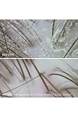 BeautyBio Healthy Scalp Serum | REVOLVE