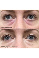 BeautyBio The Eyelighter Concentrate | REVOLVE