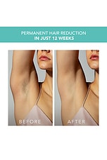 FOREO Peach 2 IPL Hair Removal Device & Peach Cooling Prep Gel Bundle ...