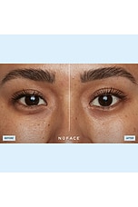 NuFACE Ionplex Hydra-gel Power Patches | REVOLVE
