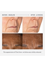 O HUI Reverse Activator Wrinkle Serum | REVOLVE