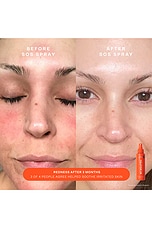 Tower 28 SOS Rescue Kit | REVOLVE