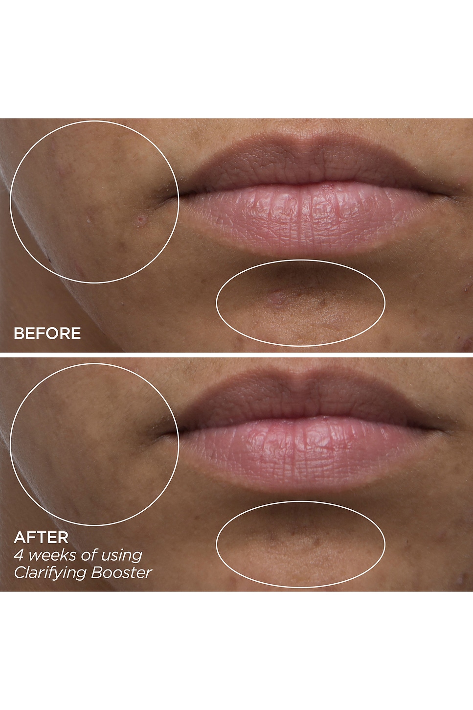 BeautyBio SÉRUM BOOSTER COM ÁCIDO SALICÍLICO CLARIFYING SALICYLIC ACID ...