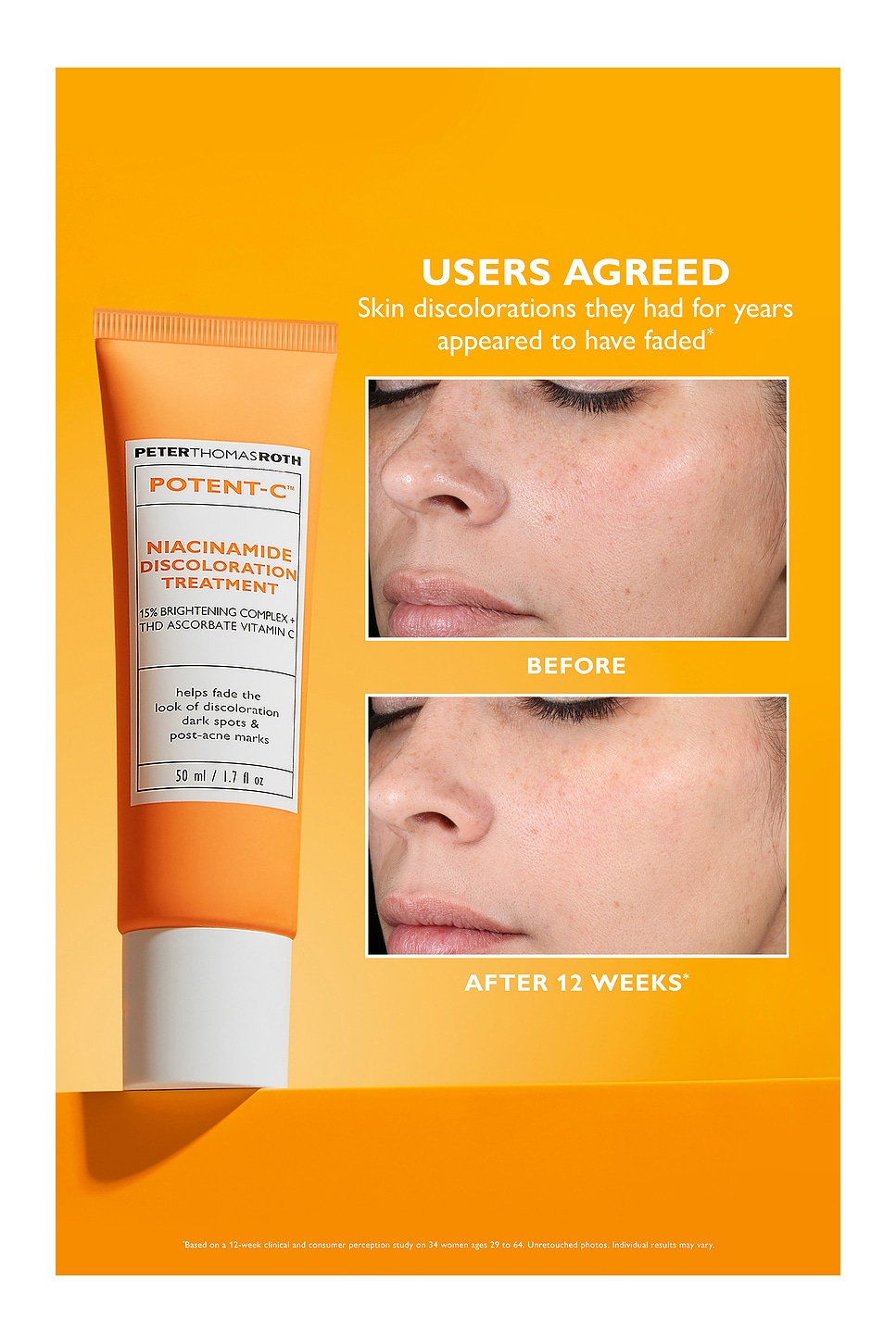 Peter Thomas Roth Potent-C Niacinamide Discoloration Treatment | REVOLVE
