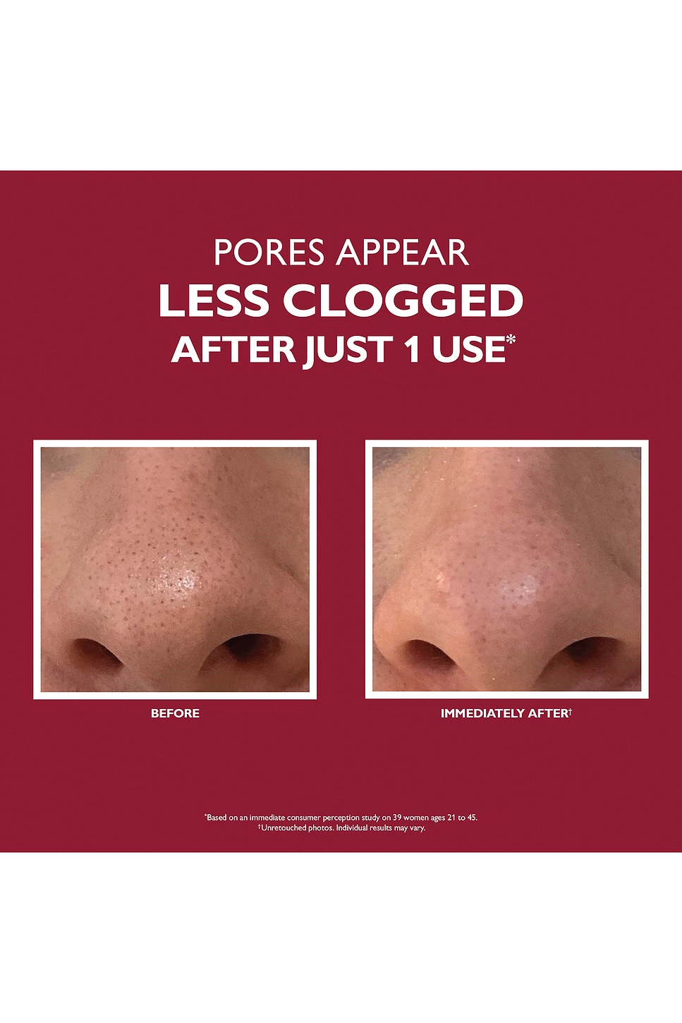 Peter Thomas Roth Even Smoother Microdermabrasion Exfoliating Pore ...
