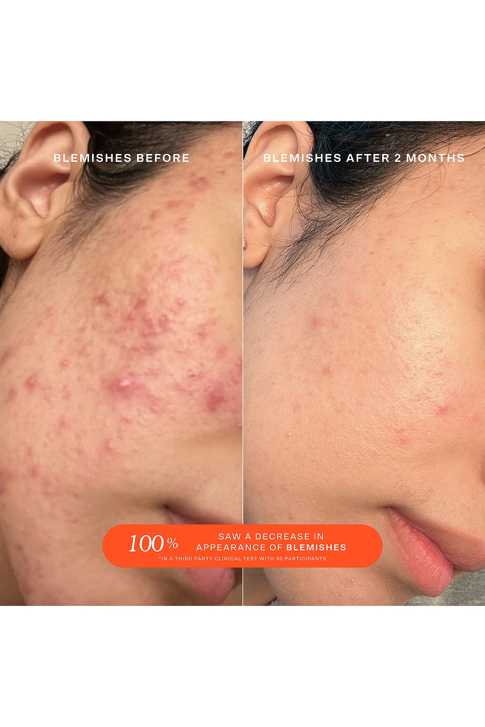 Tower 28 SOS Daily Rescue Facial Spray with Hypochlorous Acid | REVOLVE