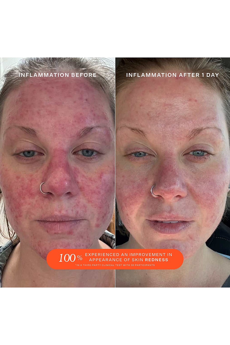 Tower 28 SOS Daily Rescue Facial Spray with Hypochlorous Acid | REVOLVE